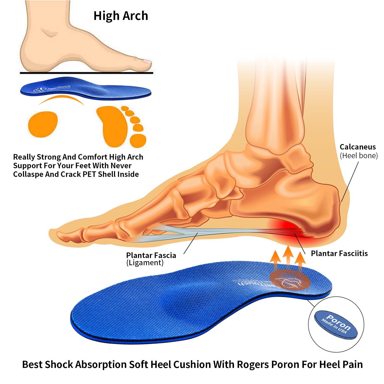 Snapklik.com : FeetTouch Arch Support Orthotics Metatarsal Pads ...