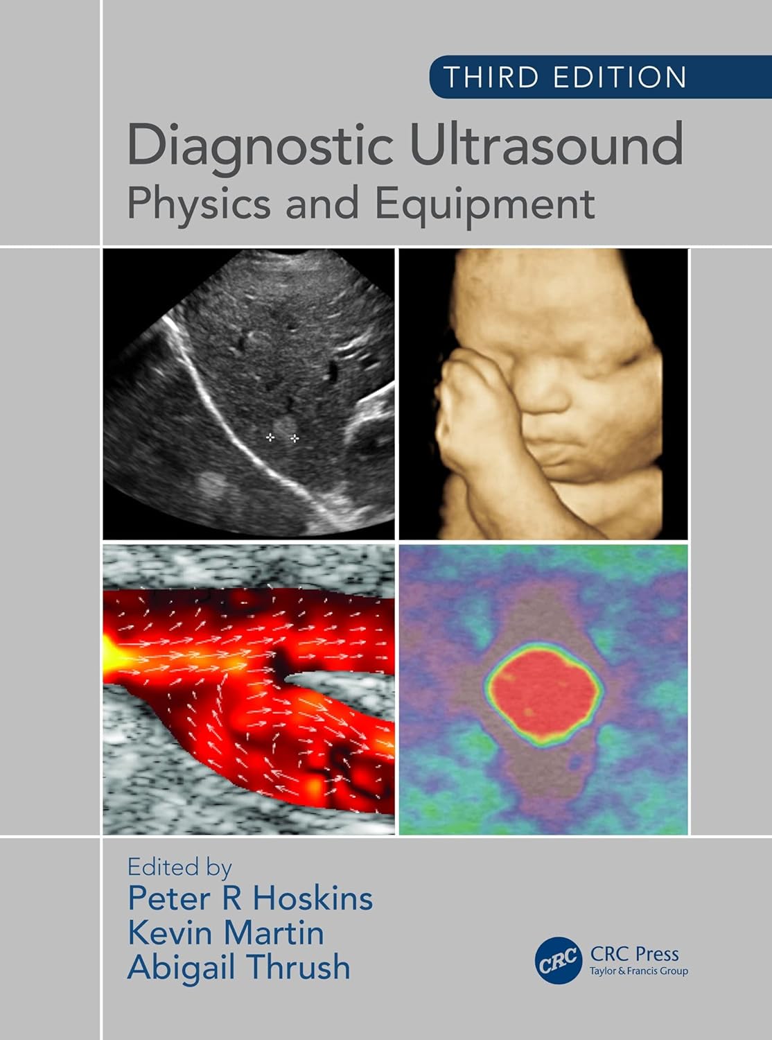 Diagnostic Ultrasound, Third Edition: Physics and Equipment ...