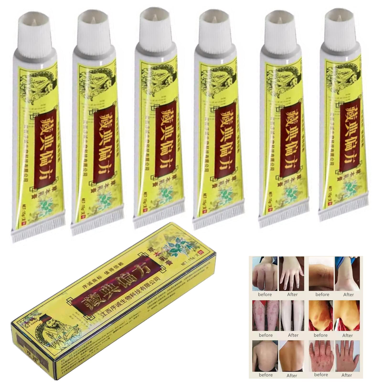 Buy 6pcsNatural Chinese al Eczema Psoriasis Cream Dermatitis Pruritus ...