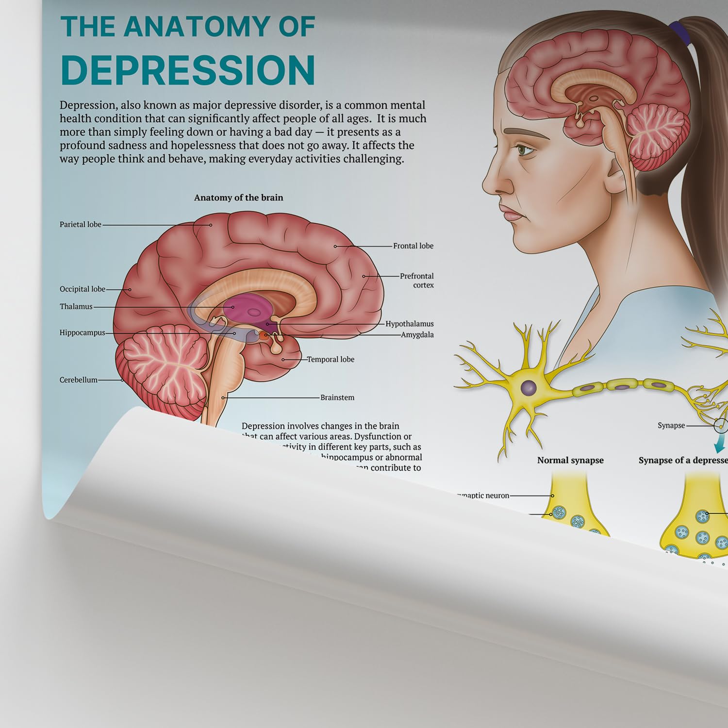 Major Depressive Disorder Brain