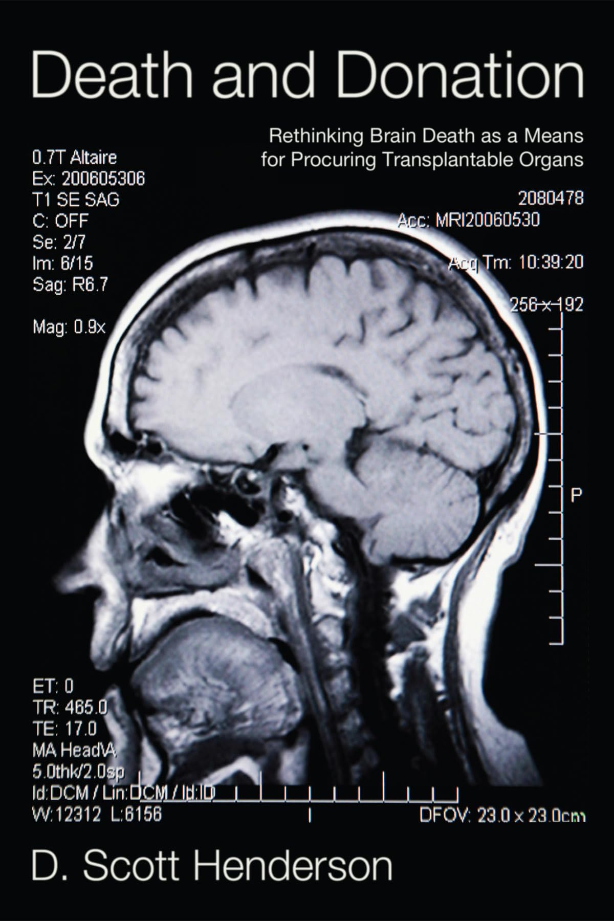 Brain Death Critical Synopsis And Key Questions In Brain Death