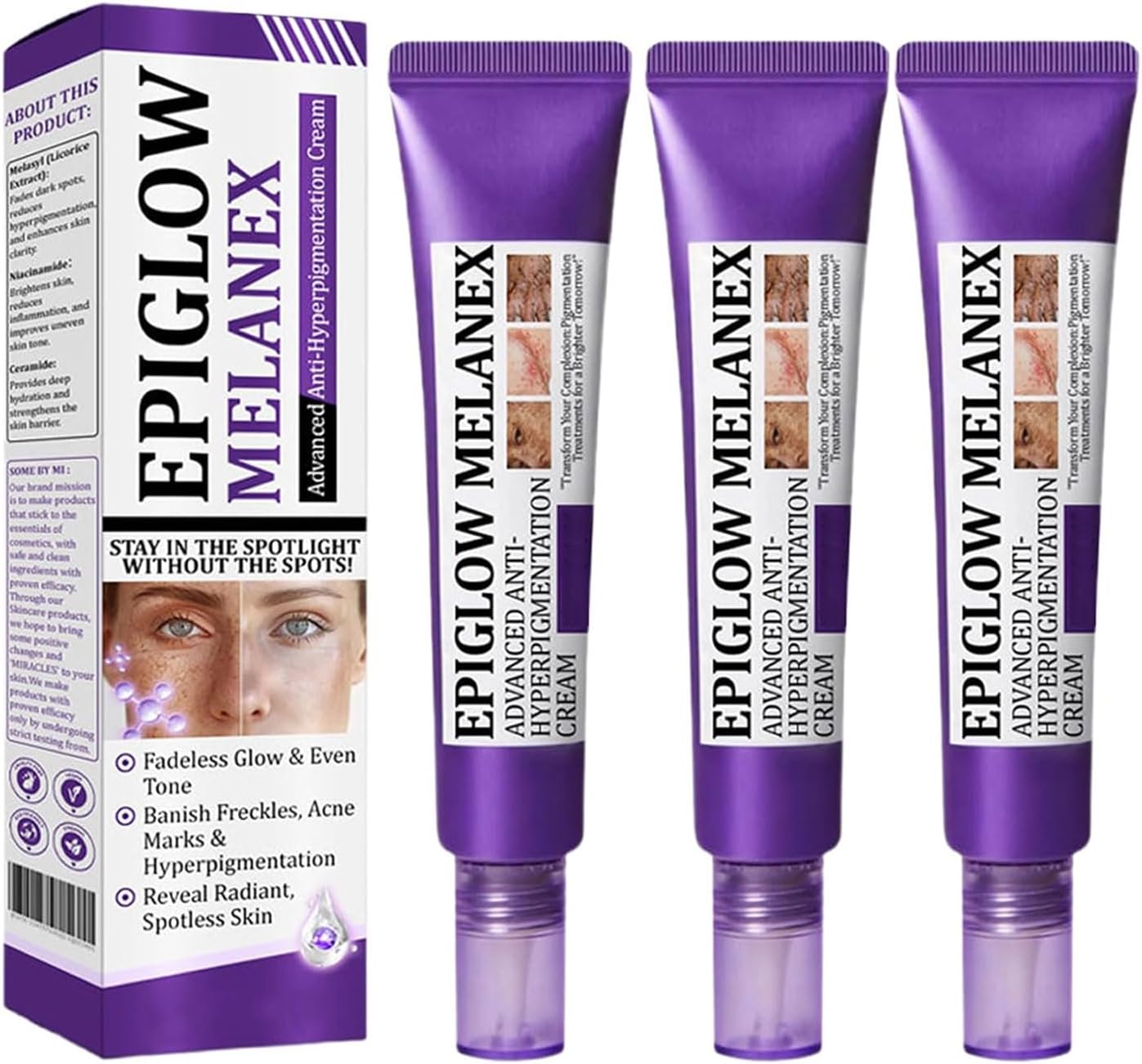 Ceoerty EPIGLOW MelanEX Advanced Anti-Hyperpigmentation Cream, Ceoerty ...