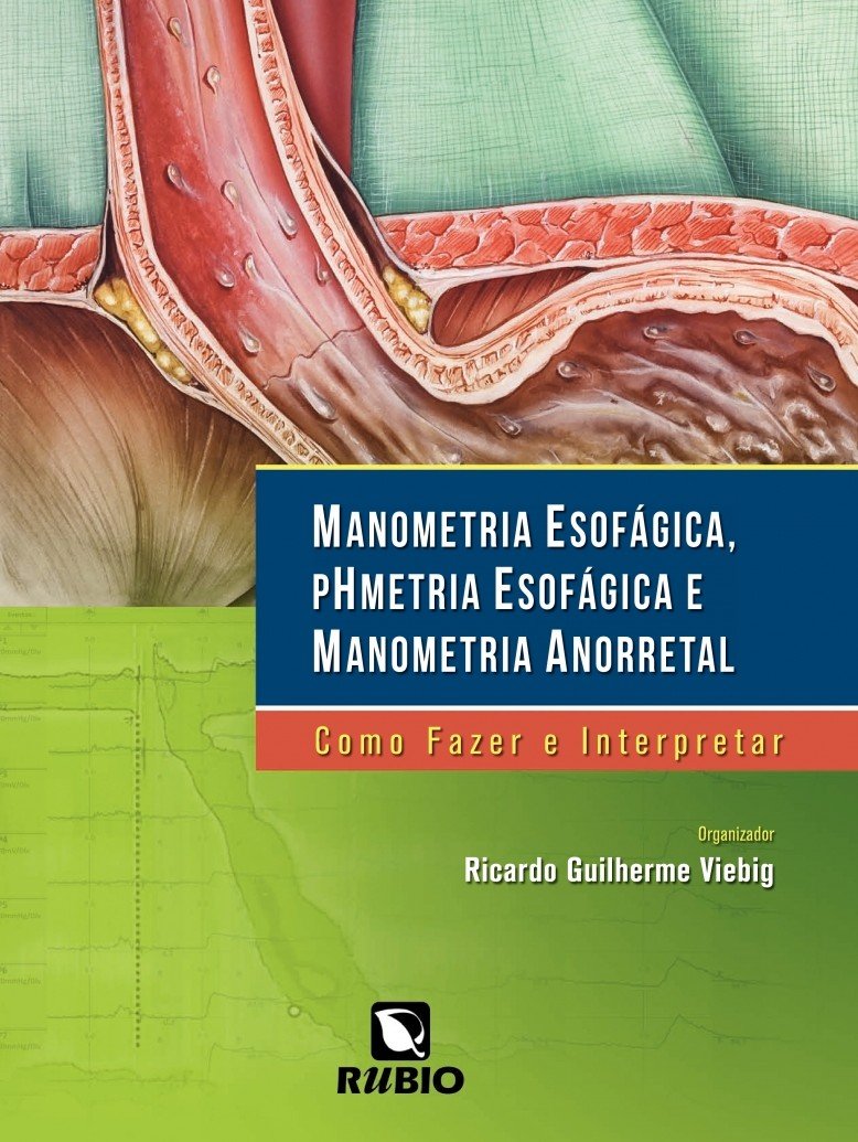 Amazon.com: Manometria Esofágica, Phmetria Esofágica e Manometria ...