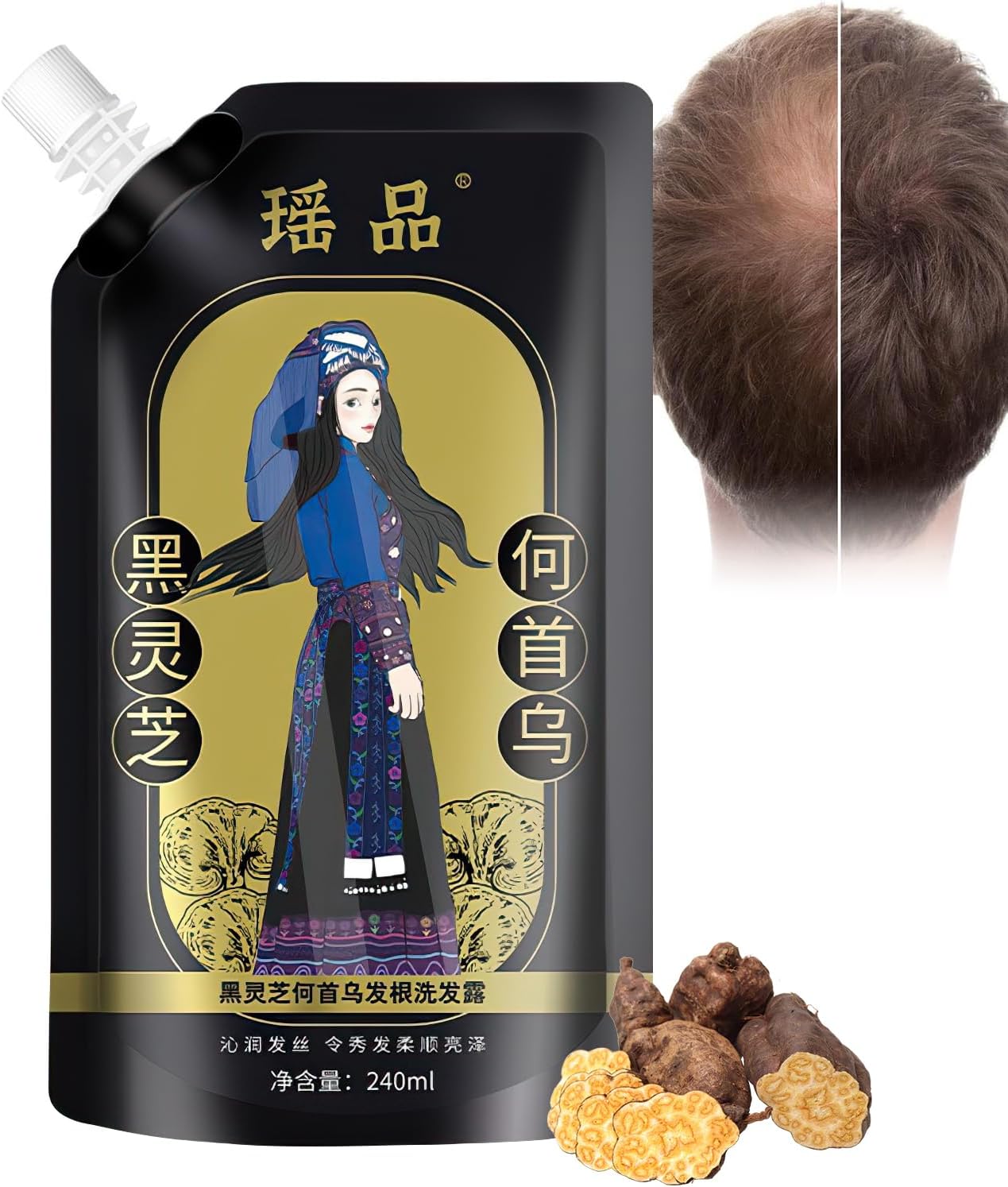 Amazon.com : Ginger Plant Extract Anti-Hair Loss Hair Shampoo,Ginger ...