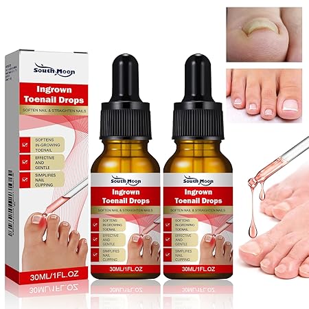 Amazon.com: 2PCS Ingrown toenail drops,Ingrown Toenail Relief,Easy Trim ...