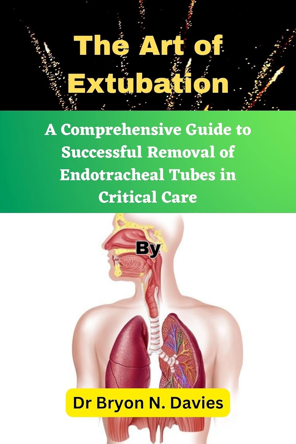 The Art of Extubation : A Comprehensive Guide to Successful Removal of ...
