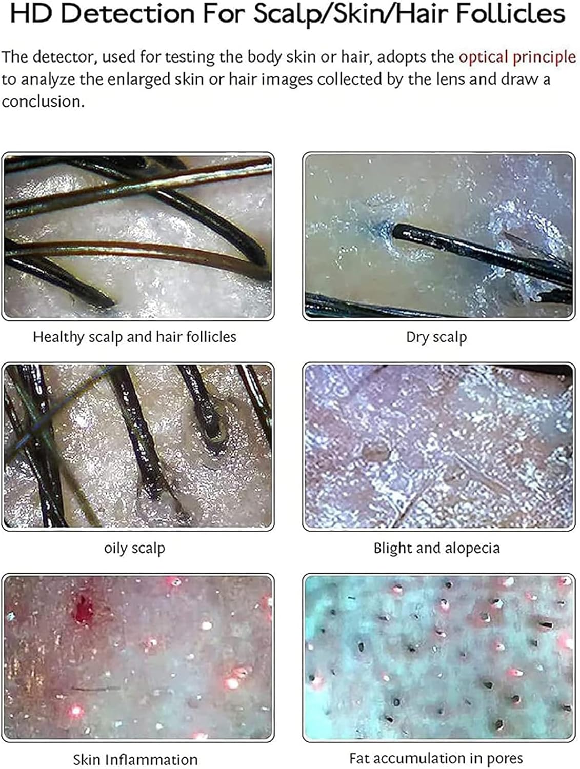 Skin Diagnosis Hair Analyzer,Scalp Hair Follicle Philippines | Ubuy