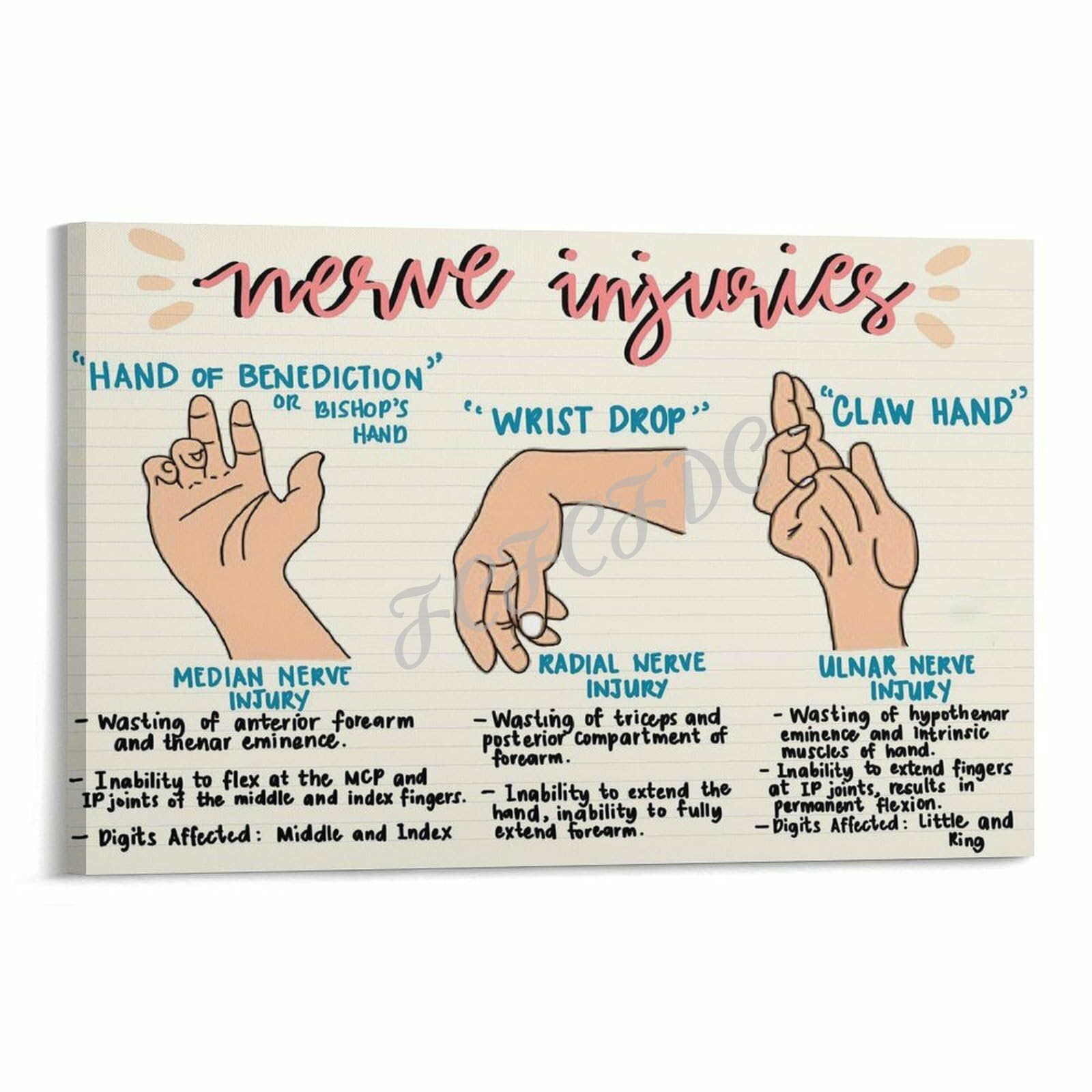 Hand Injury Poster