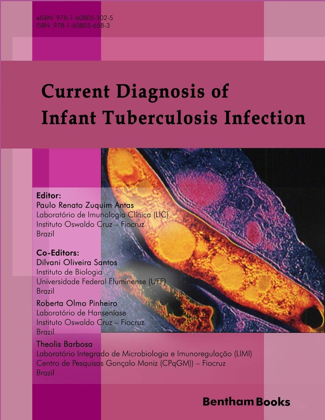 Buy Current Diagnosis of Infant Tuberculosis Infection: , Roberta Olmo ...