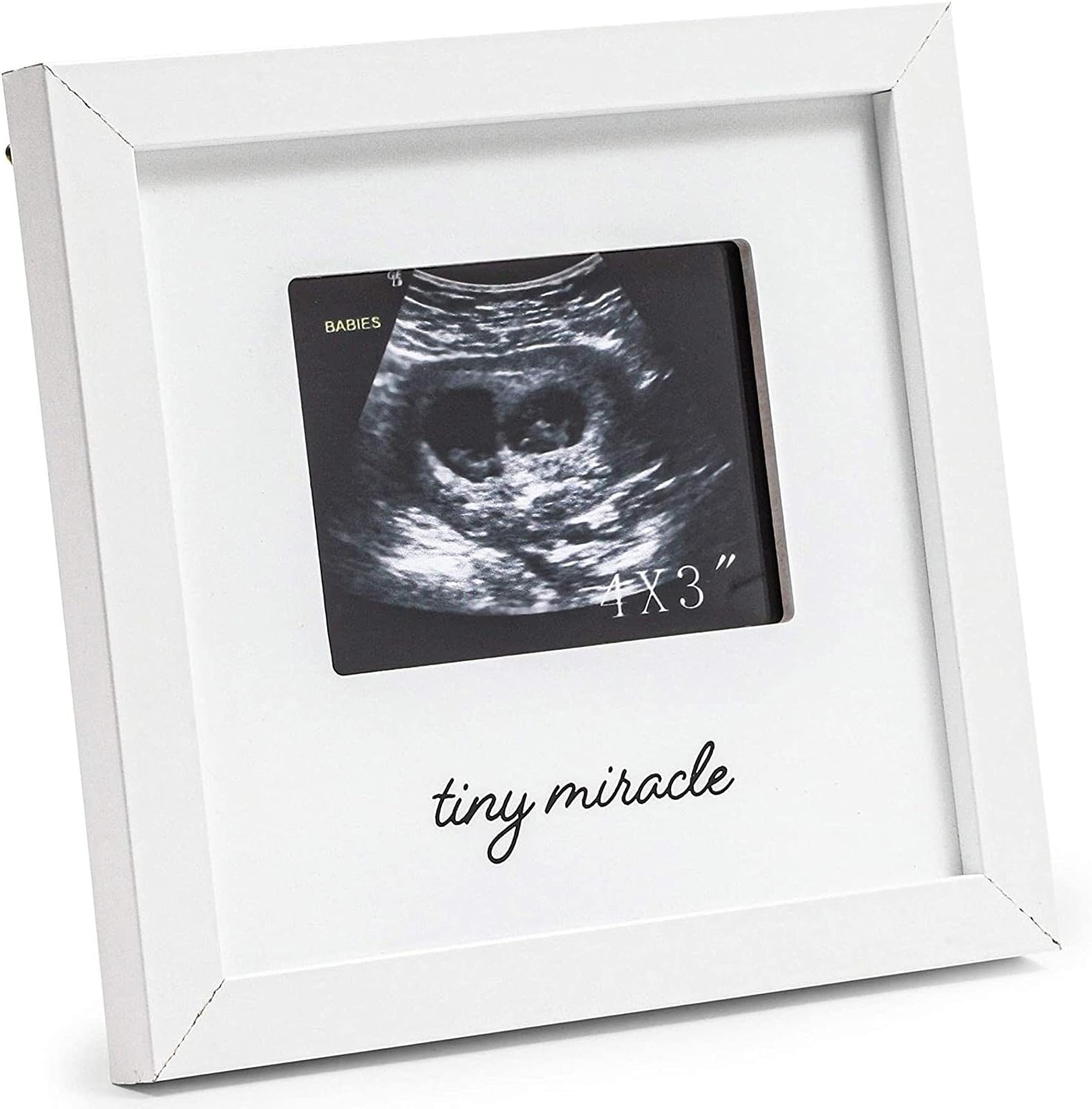 Amazon.com: Juvale Baby Sonogram Picture Frame for 4 x 3 Ultrasound ...