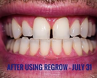 Amazon.com : REGROW Remineralizing Tooth Powder - Whiter Teeth ...