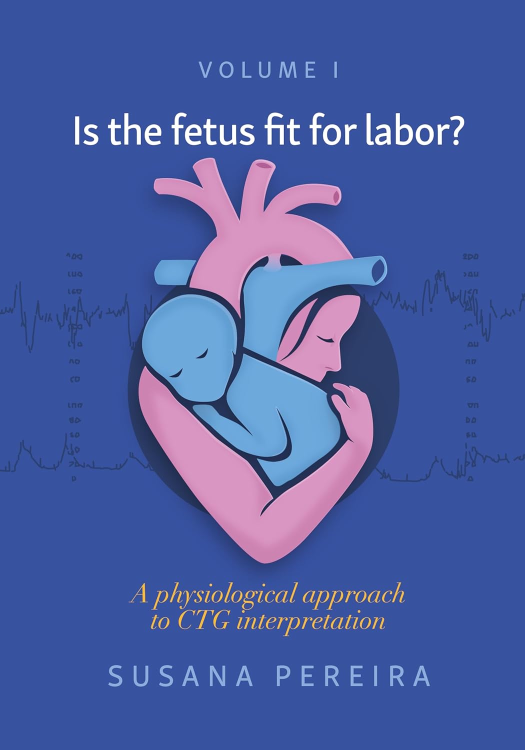 Is the fetus fit for labor?: A physiological approach to CTG ...