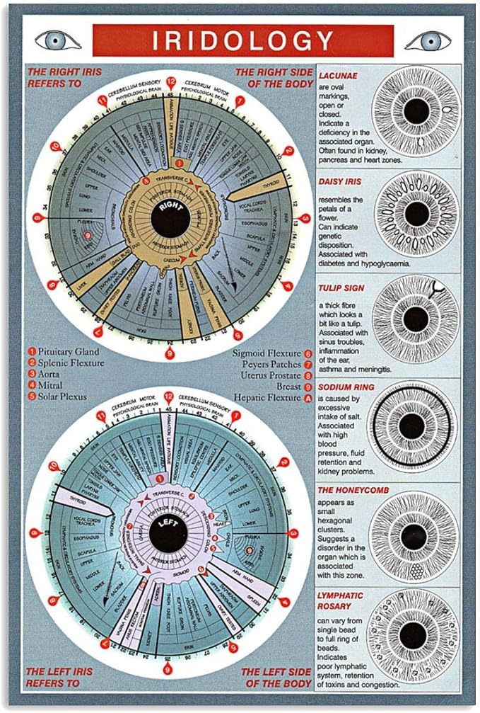 Amazon.com: JIUFOTK Iridology Knowledge Posters Optometrist Science Guide Metal Signs Room Club ...
