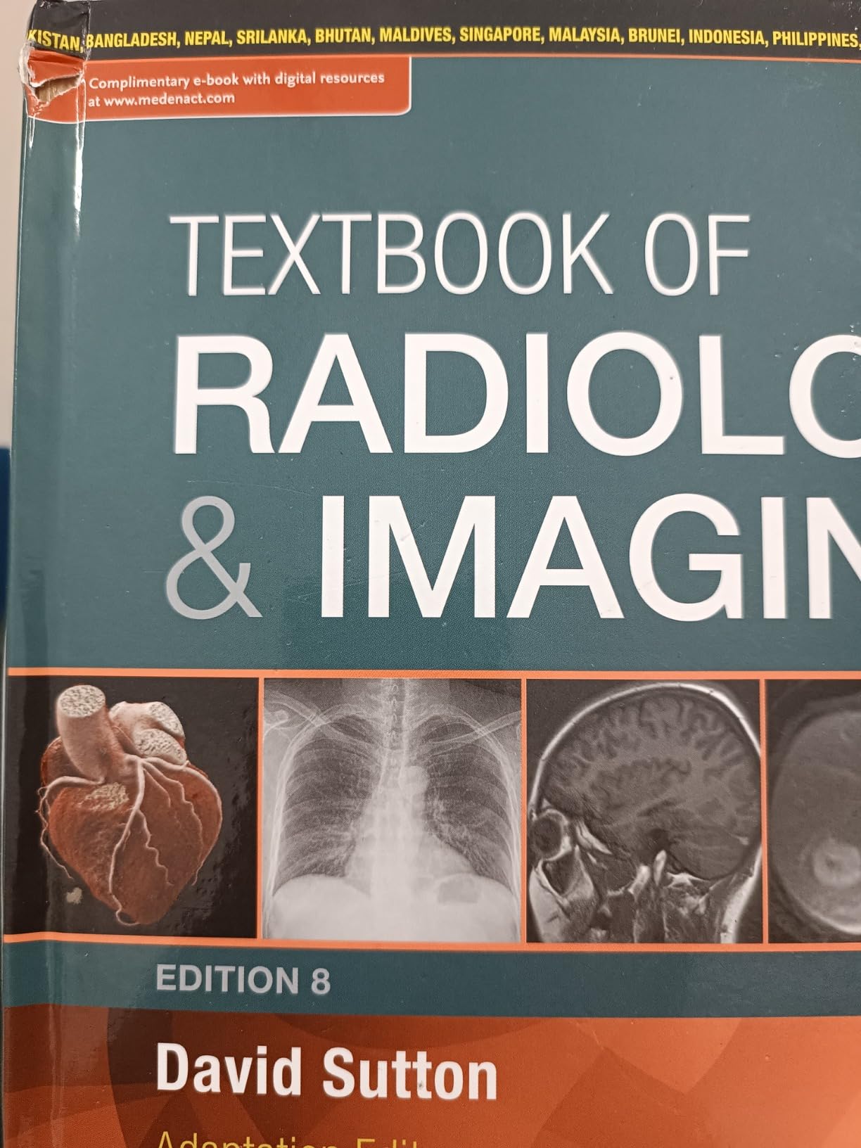 Buy TEXTBOOK OF RADIOLOGY AND IMAGING WITH ACCESS CODE 2 VOL SET 8ED ...