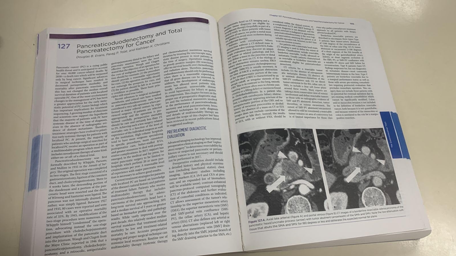 Fischer’s Mastery Of Surgery 7/E (Volume 1) eBook : Fischer: Amazon.in ...