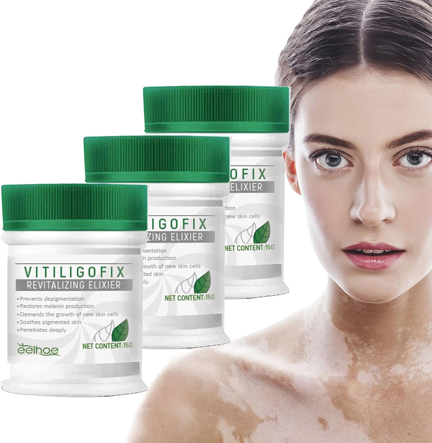 Vitiligo Fix Revitalize Elixir, Vitiligo Treatment Cream, Treat ...