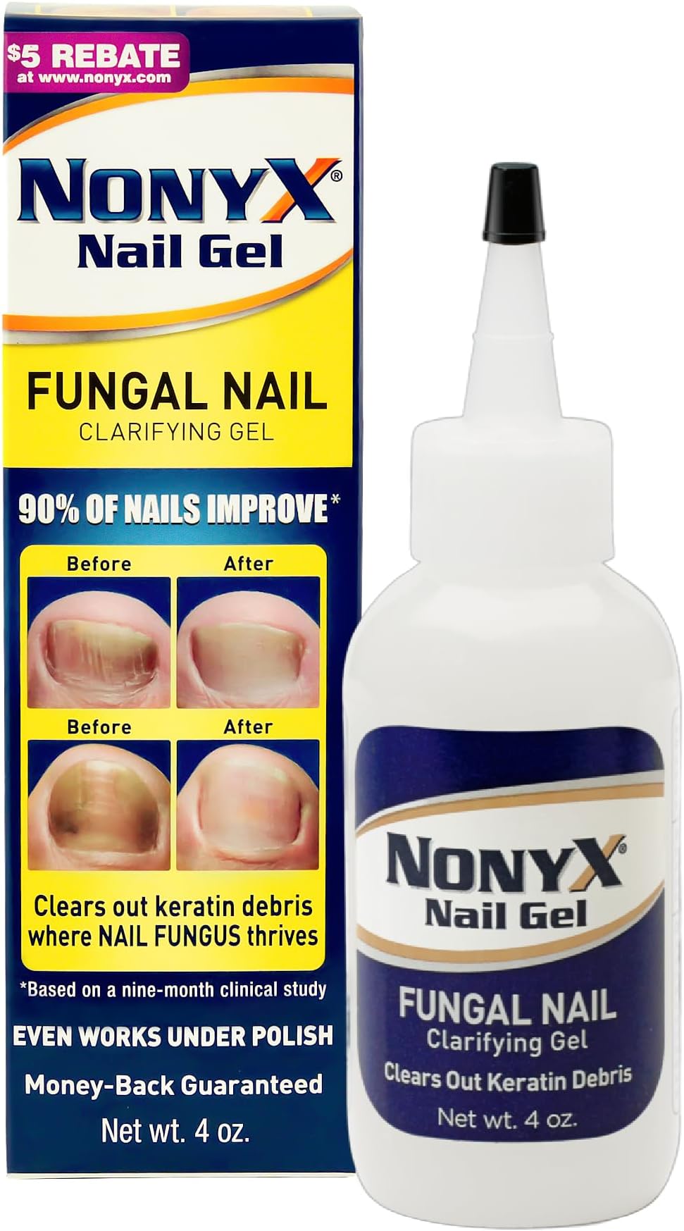 Amazon.com : Dr. G's Clear Nail Antifungal Treatment, 0.5 Fluid Ounce ...