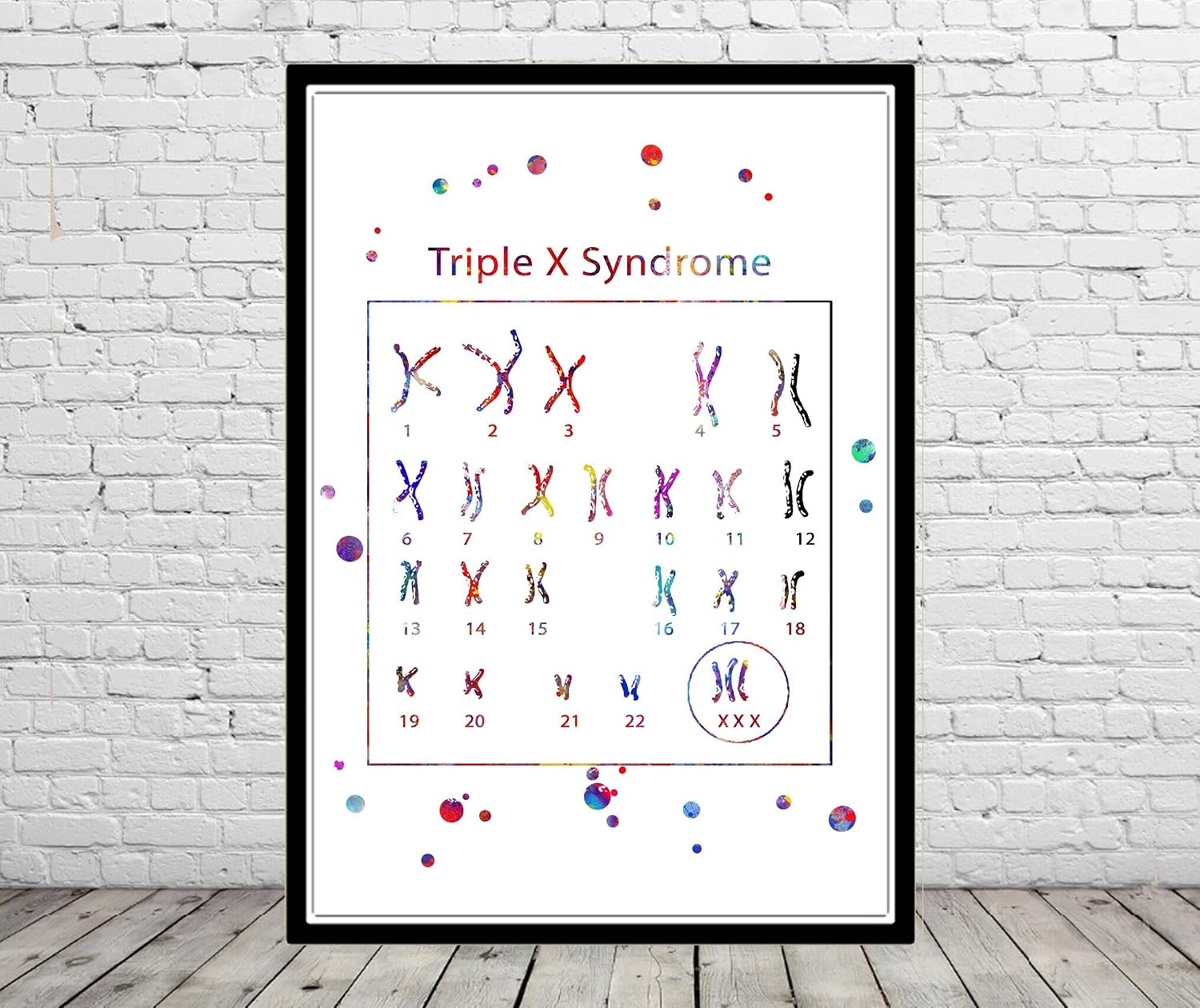 Amazon.com: Triple X Syndrome, Medical art, trisomy X, extra X ...