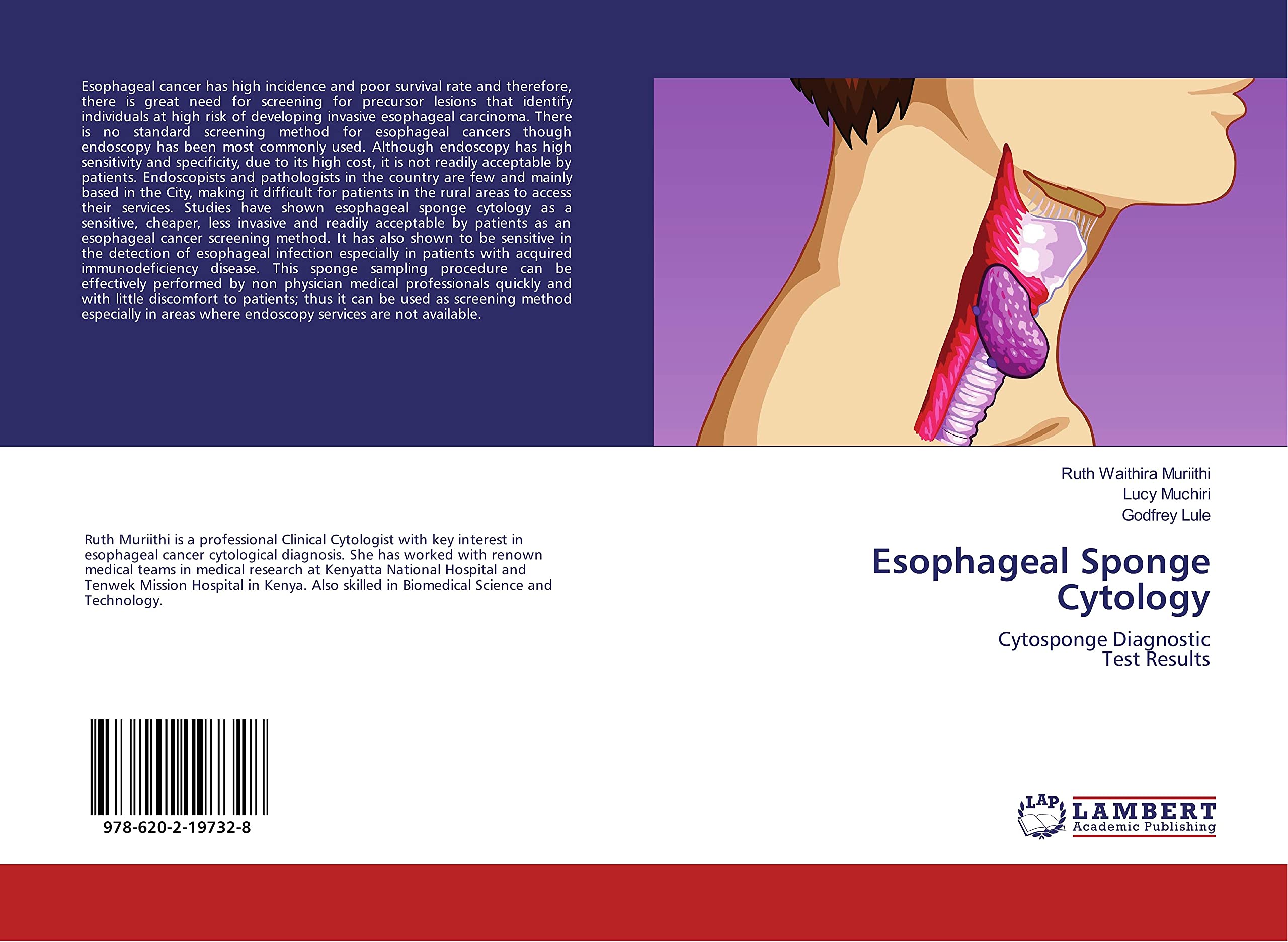 Esophageal Sponge Cytology: Cytosponge Diagnostic Test Results: Amazon ...