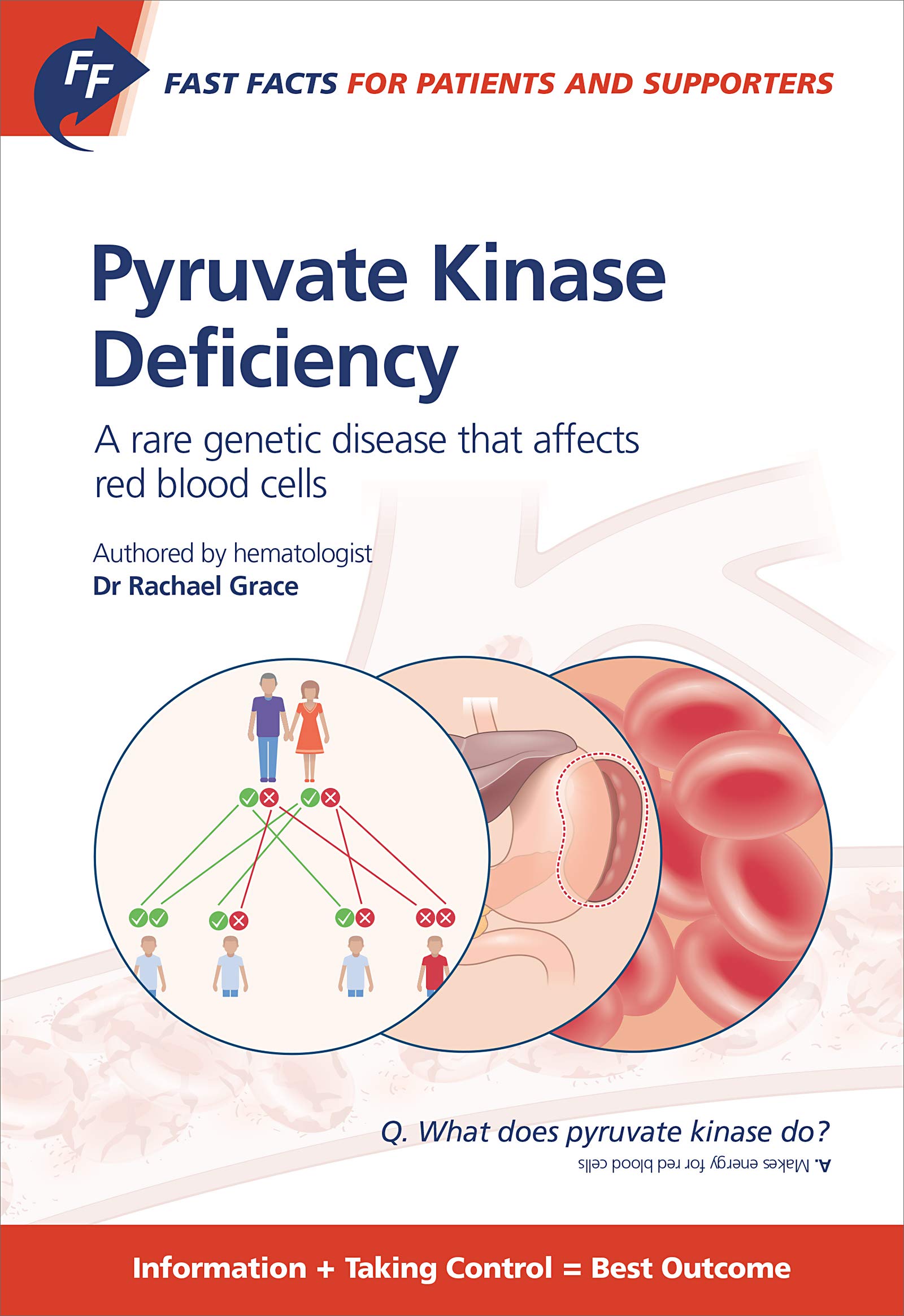 Buy Fast Facts: Pyruvate Kinase Deficiency for Patients and Supporters ...