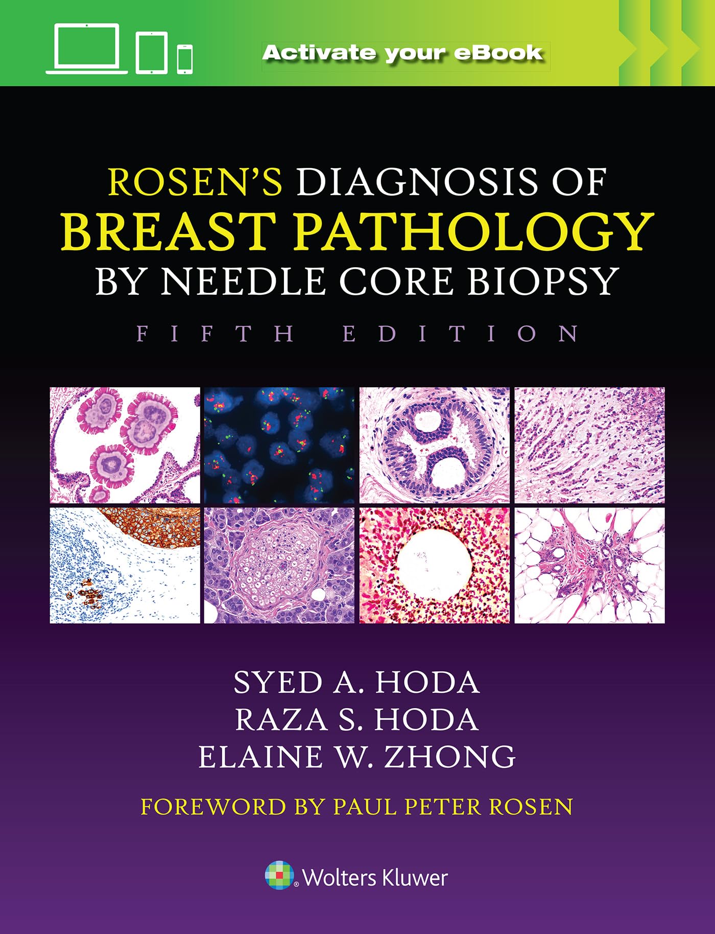 Rosen's Diagnosis of Breast Pathology by Needle Core Biopsy: Amazon.co ...