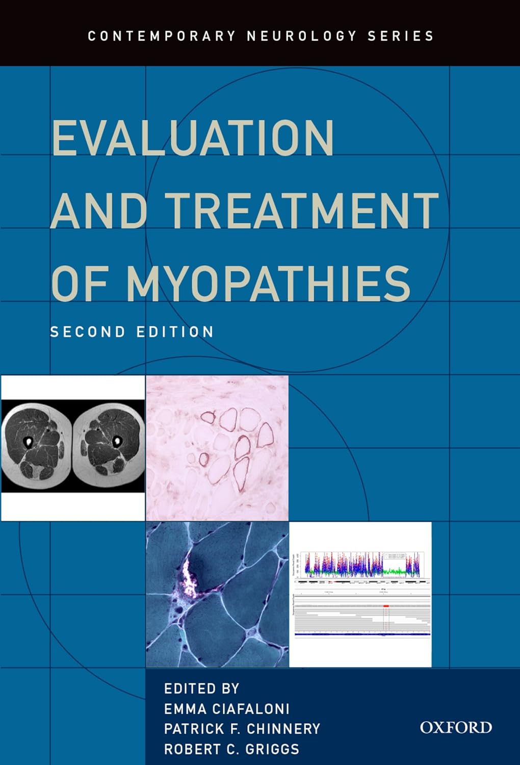 Evaluation and Treatment of Myopathies (Contemporary Neurology Series ...