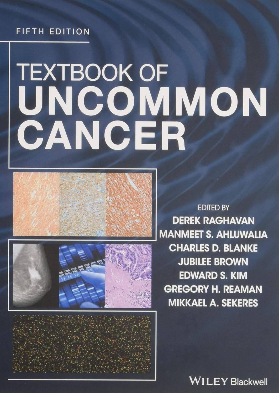 Textbook of Uncommon Cancer: 9781119196204: Medicine & Health Science ...
