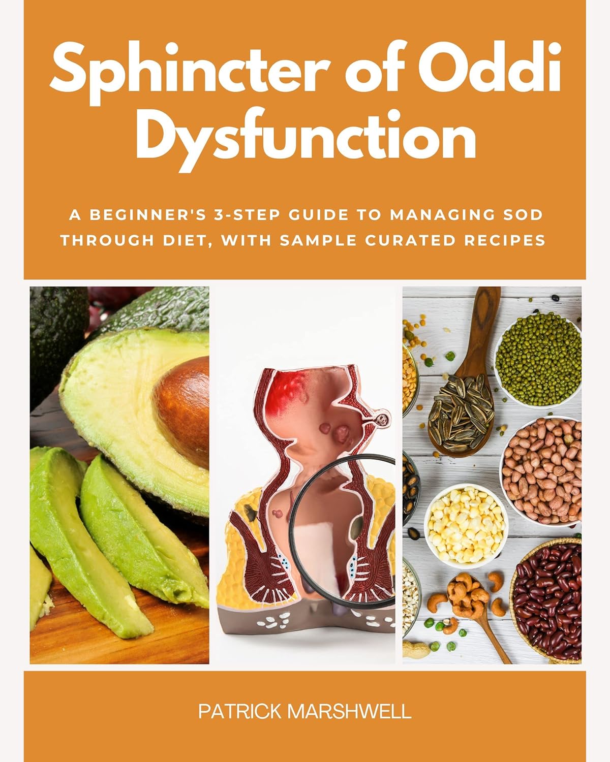 Sphincter of Oddi Dysfunction: A Beginner's 3-Step Guide to Managing ...