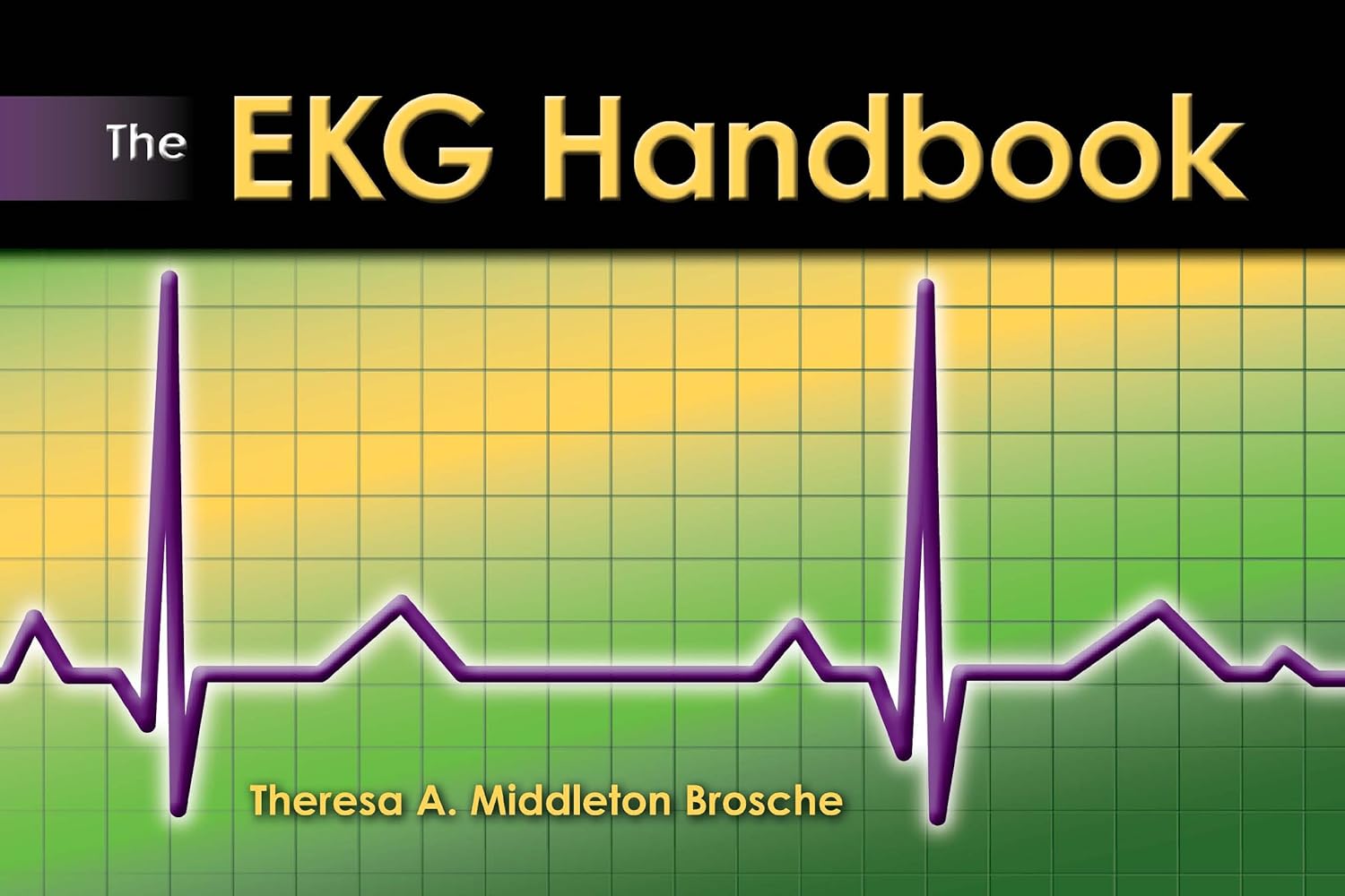 Amazon.com: The EKG Handbook eBook : Brosche, Theresa A. Middleton: Books