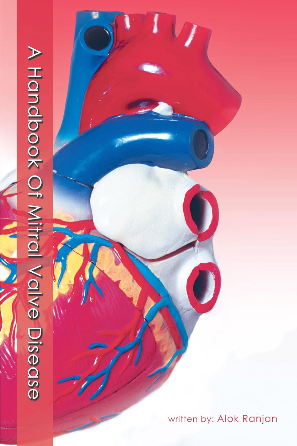 A Handbook of Mitral Valve Disease eBook : Ranjan, Alok: Amazon.co.uk ...