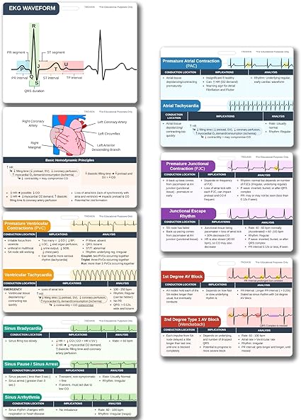 Amazon.com : EKG Pocket Badge Cards – 7 Double-Sided Nurse ECG ...