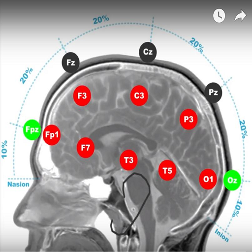 ZAP your BRAIN with SMARTPHONE:Amazon.com:Appstore for Android