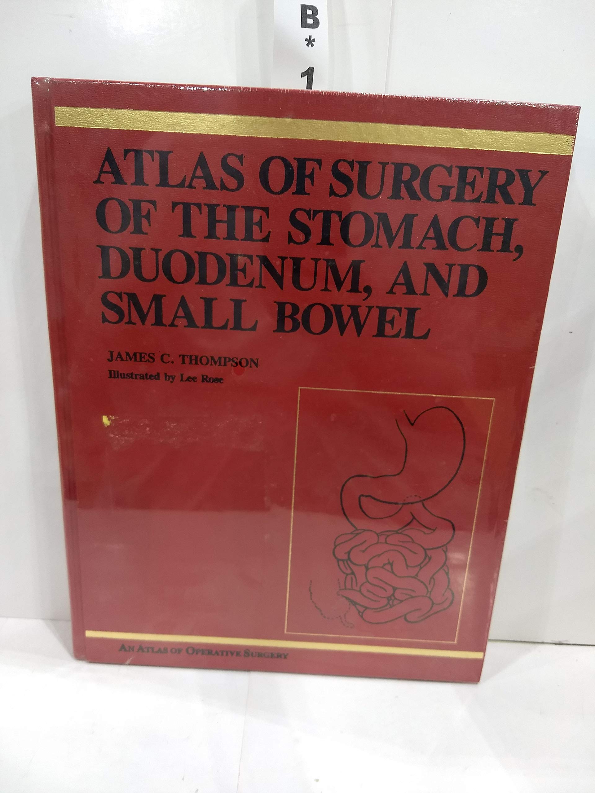 Atlas of Surgery of the Stomach, Duodenum, and Small Bowel (The Atlases ...