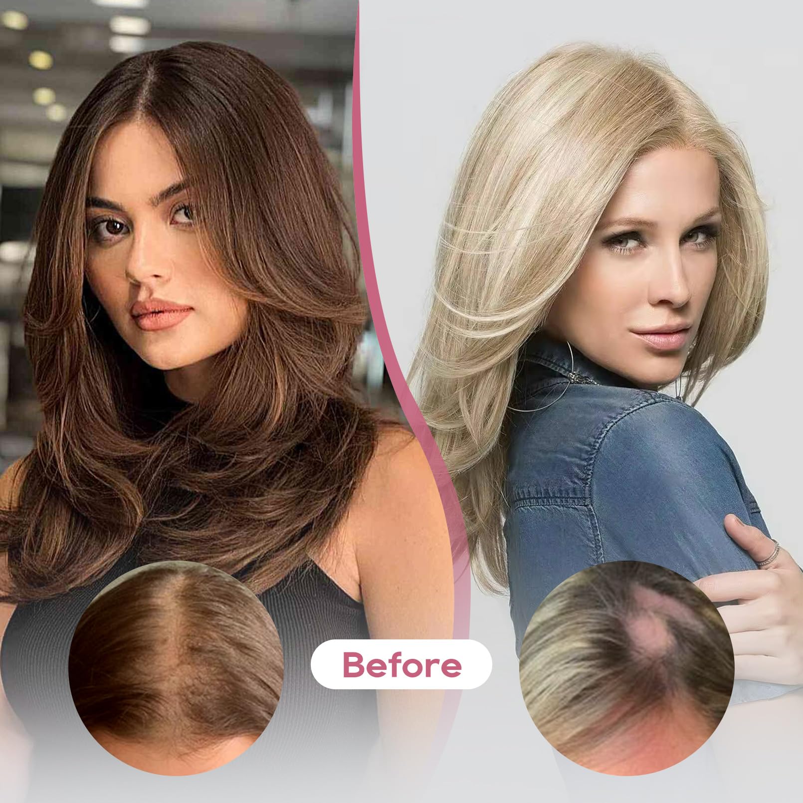 REECHO Real Human Hair Topper, 10 inch Women Hair Toppers for Thinning ...