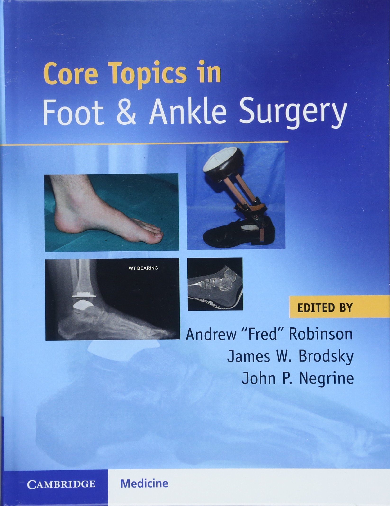 Core Topics in Foot and Ankle Surgery: 9781108418935: Medicine & Health ...