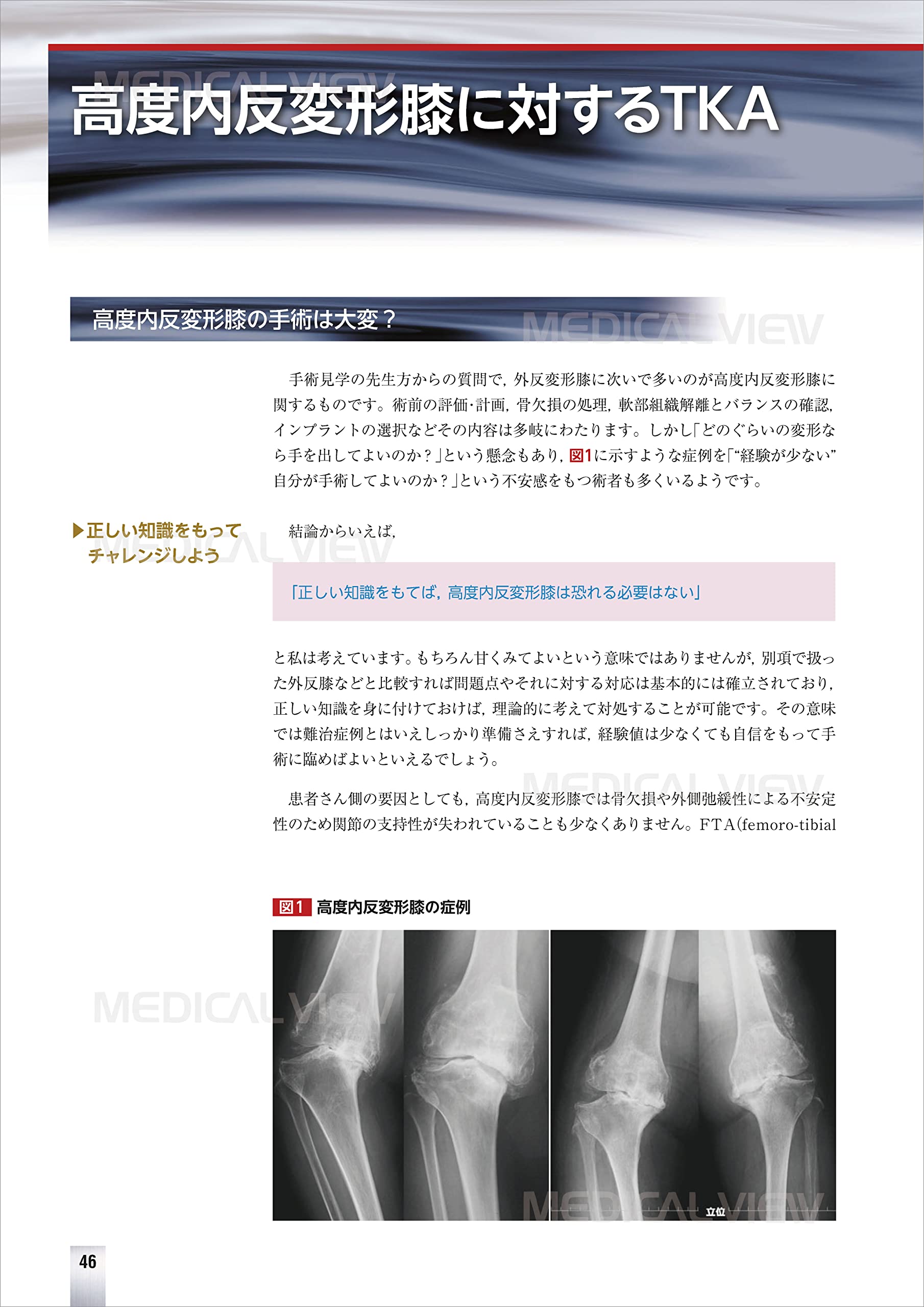 つせんたー 阪和人工関節センターTKAマニュアル PayPayモール店 - 通販 - PayPayモール Advanced Course 有隣堂 からメール