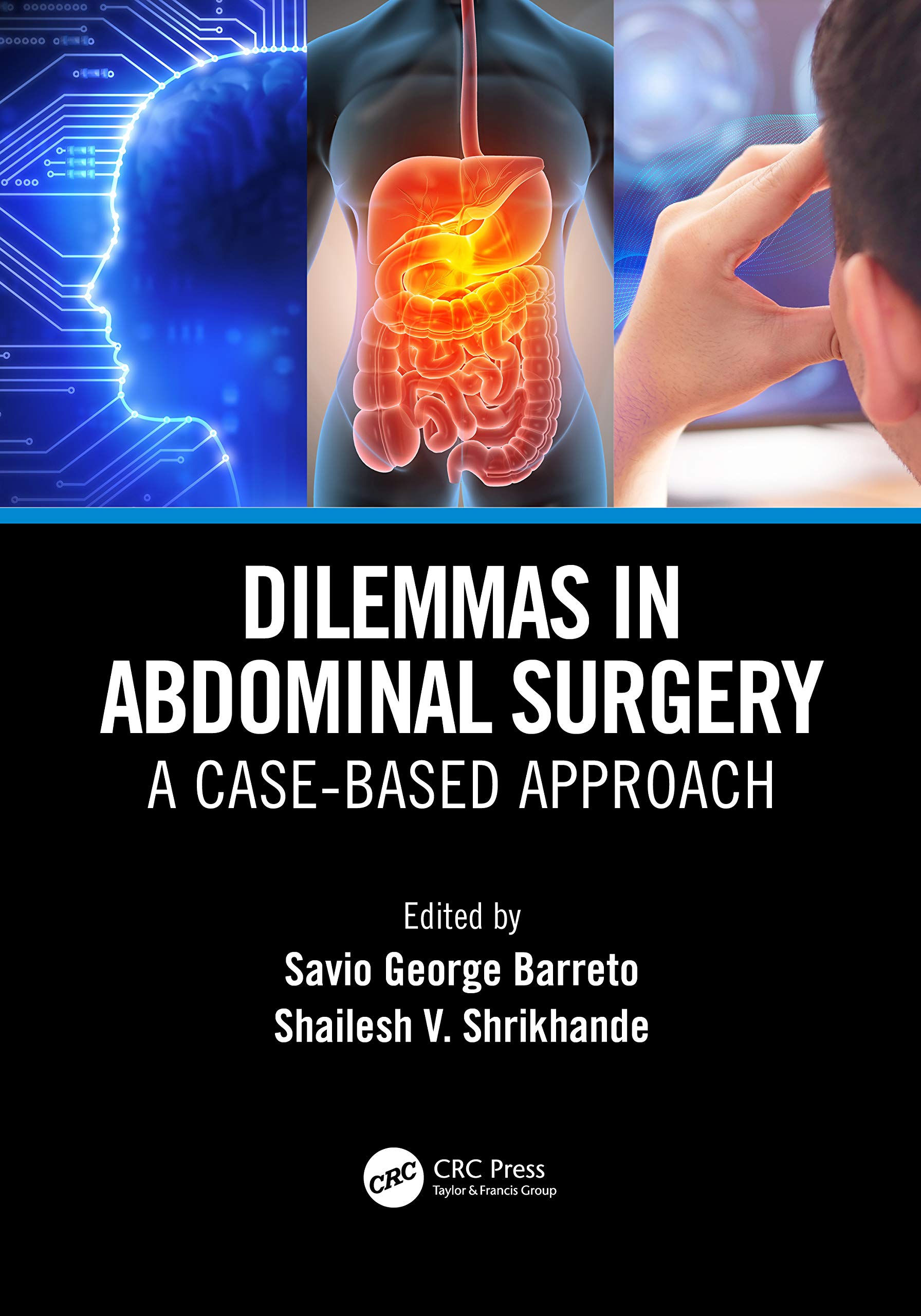 Dilemmas in Abdominal Surgery: A Case-Based Approach: 9780367187699 ...