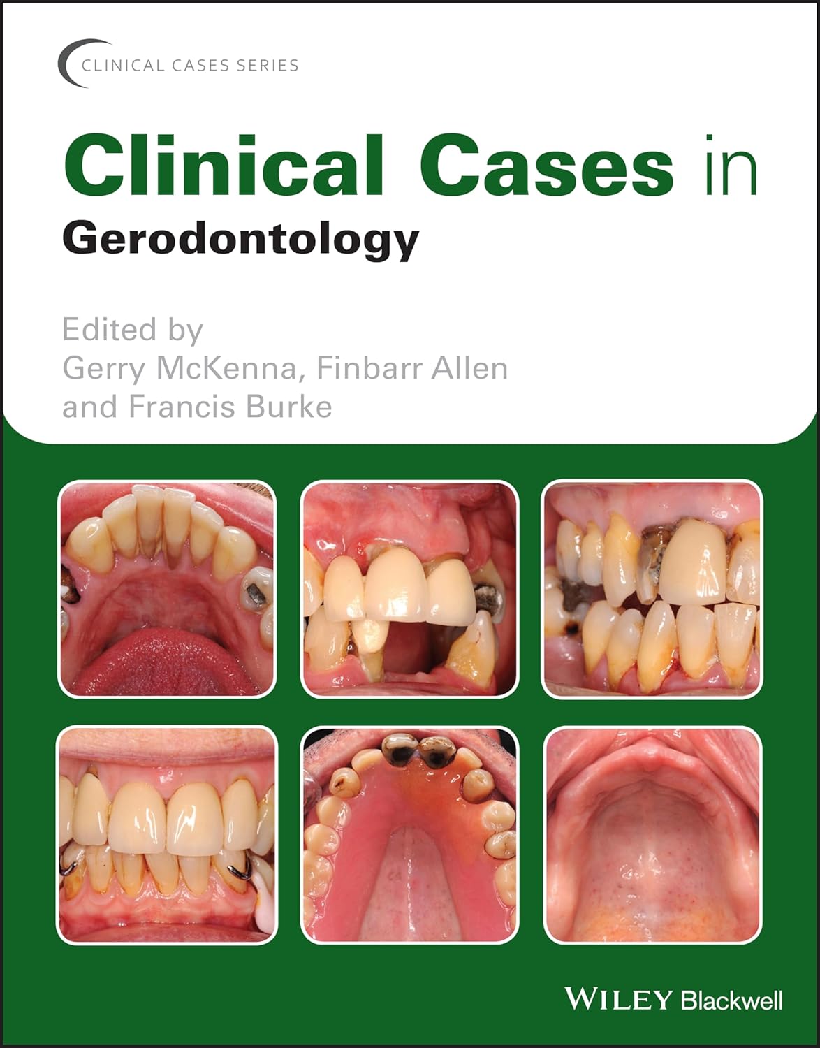 Clinical Cases in Gerodontology (Clinical Cases (Dentistry ...