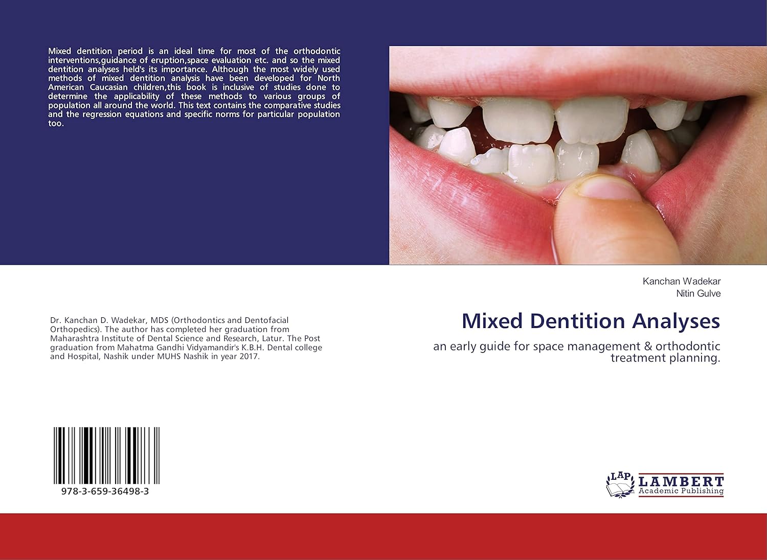 Buy Mixed Dentition Analyses: An early guide for space management ...