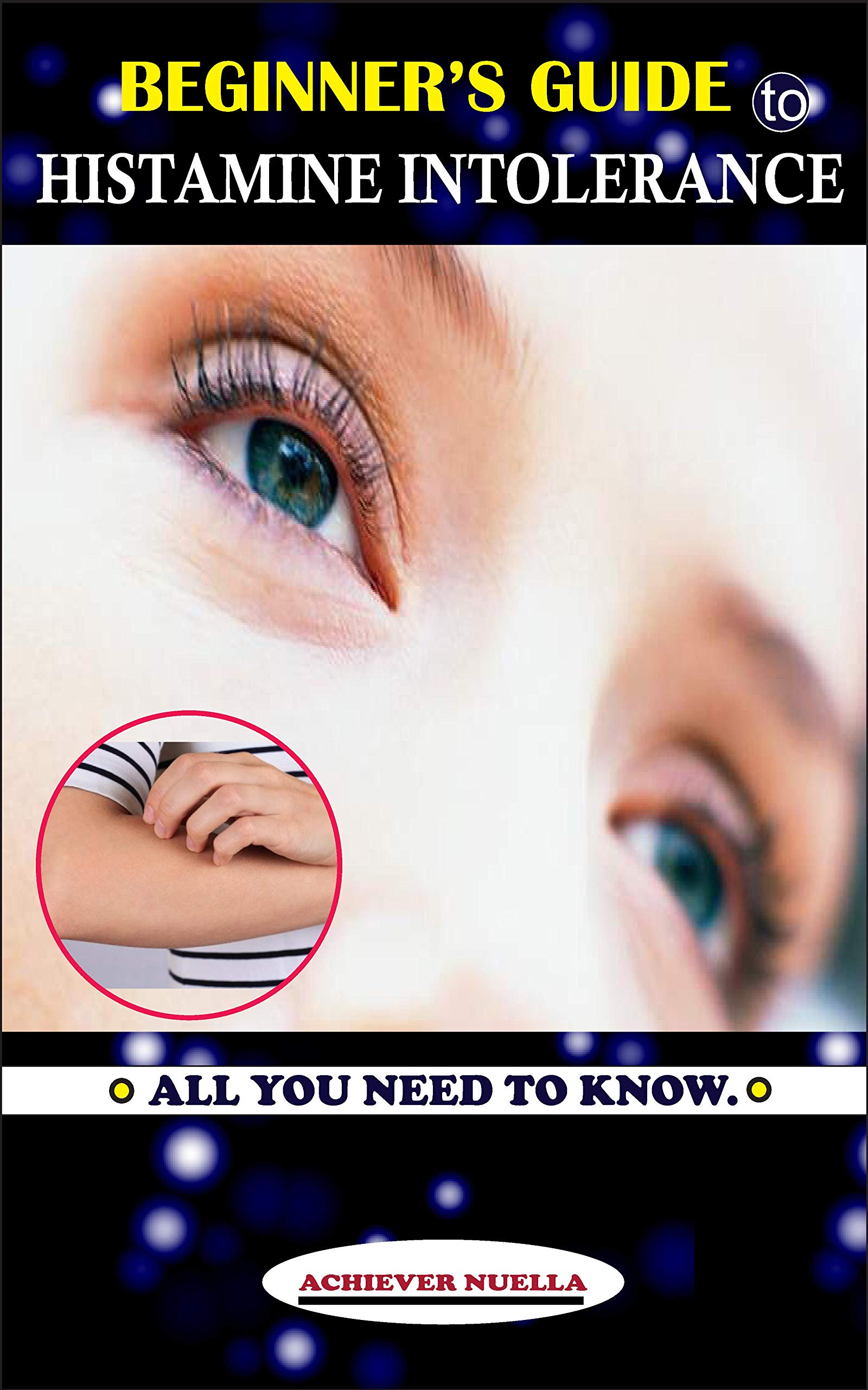 Beginners Guide To Histamine Intolerance All You Need To Know ...