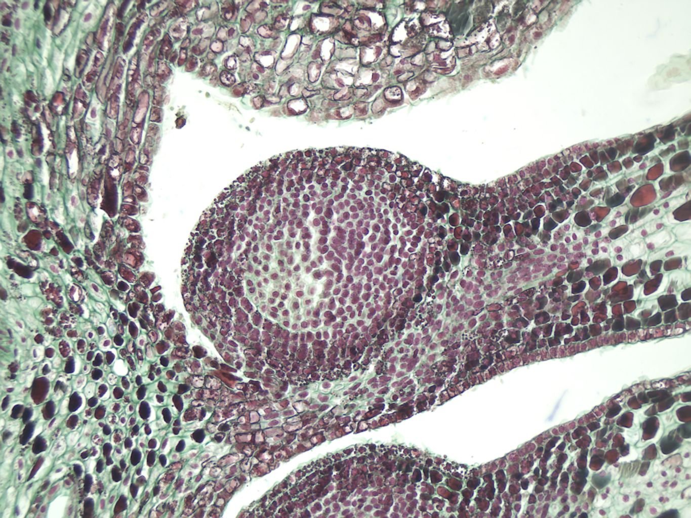 470181-202 - Pine, Ovulate Cone - Pine, Ovulate Cone Slide - Each ...