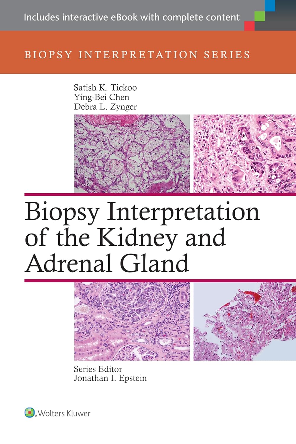 Biopsy Interpretation of the Kidney & Adrenal Gland (Biopsy Interpretation Series): Tickoo ...