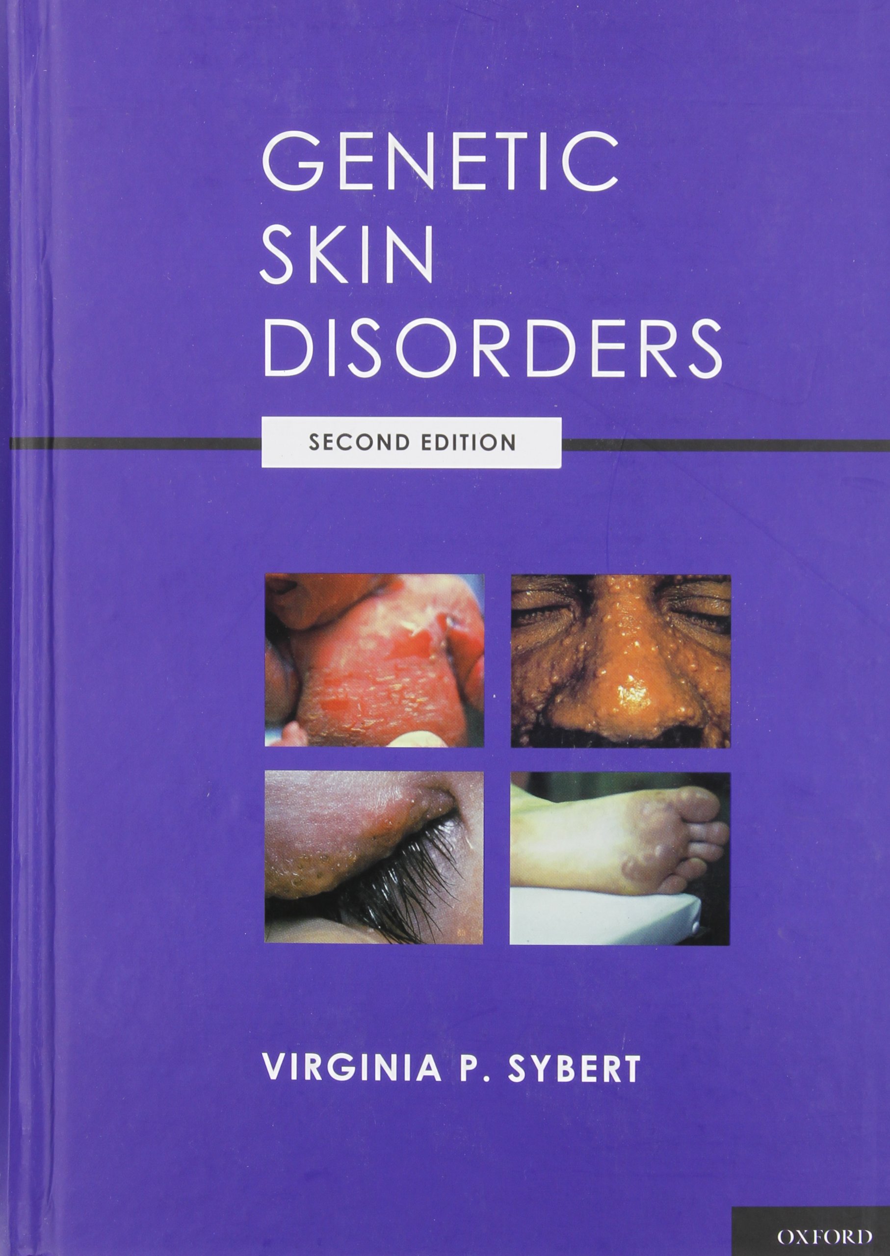 Genetic Skin Disorders (Oxford Monographs on Medical Genetics ...