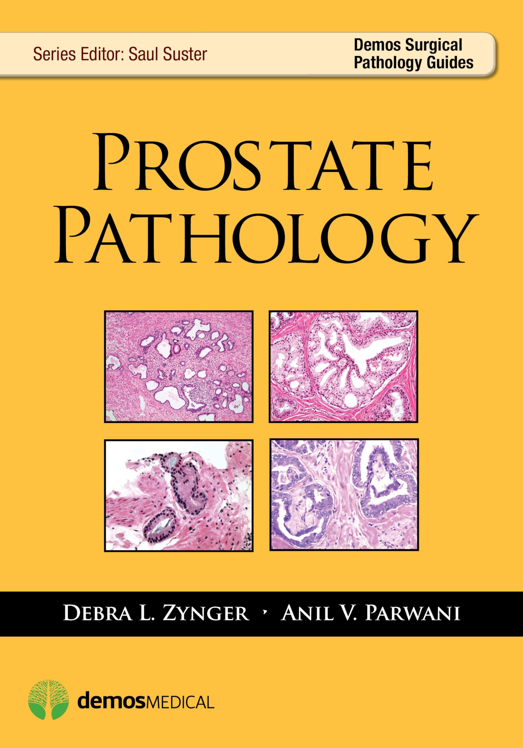 Prostate Pathology (Demos Surgical Pathology Guides): 9781936287901 ...