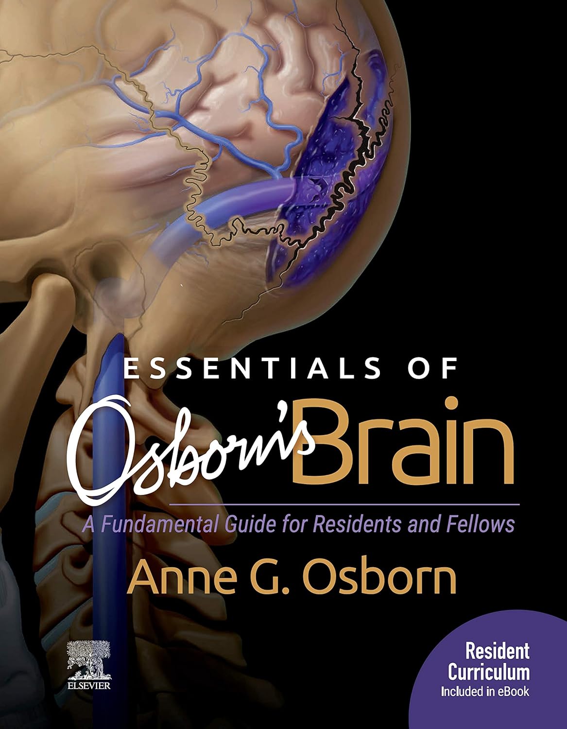 Amazon.com: Essentials of Osborn's Brain: Essentials of Osborn's Brain ...