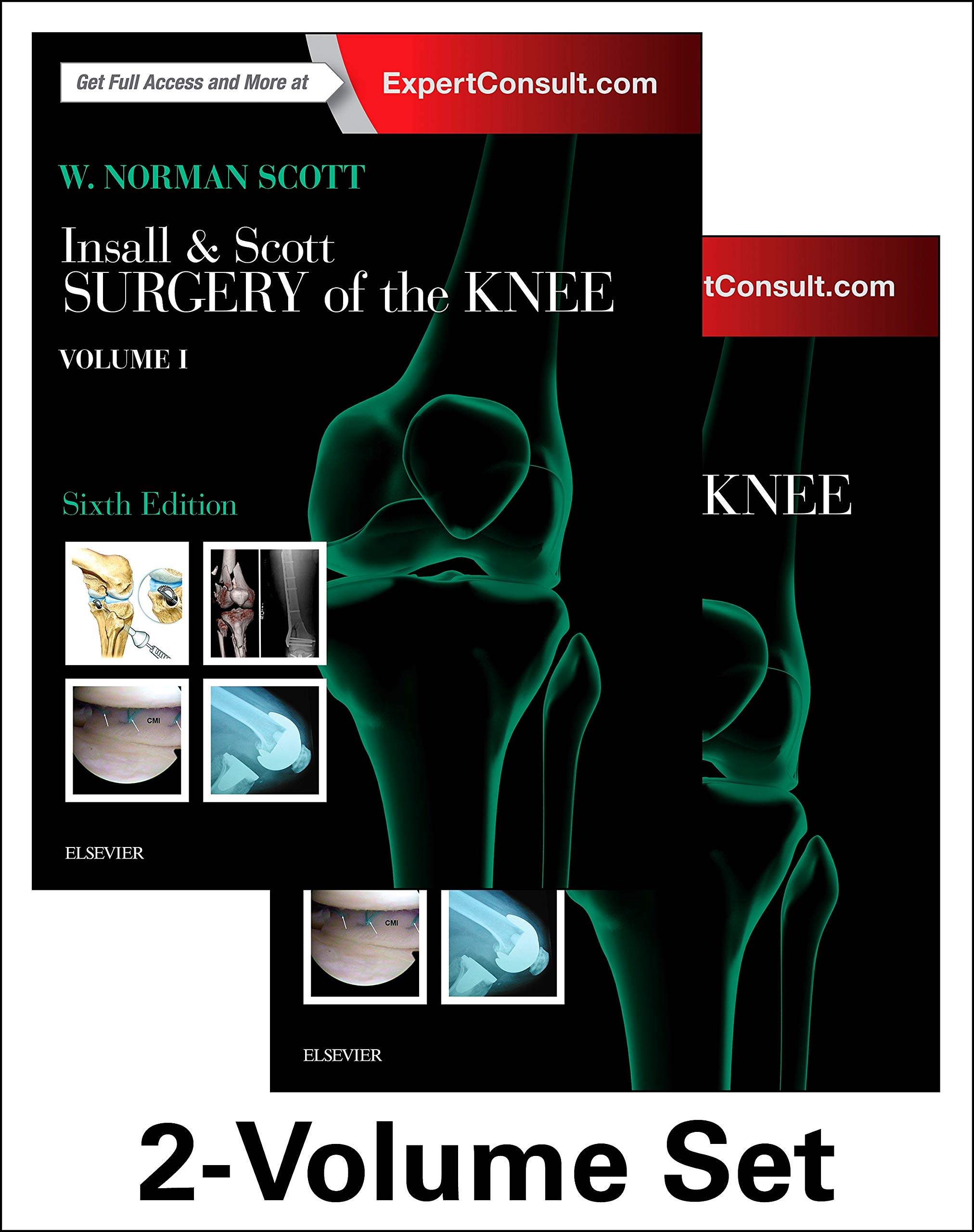 Insall & Scott Surgery of the Knee, 2-Volume Set: Expert Consult ...