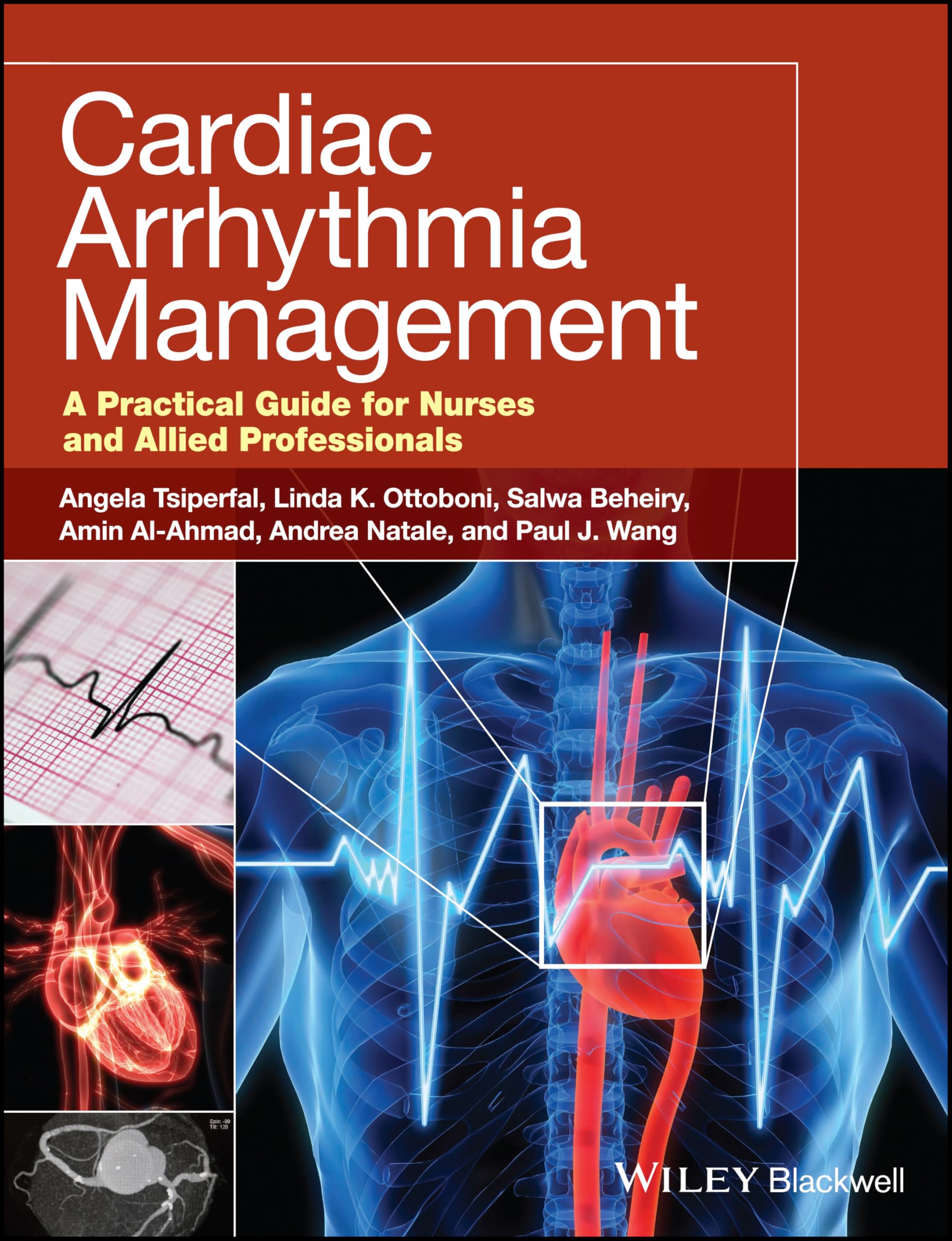 Cardiac Arrhythmia Management: A Practical Guide for Nurses and Allied ...