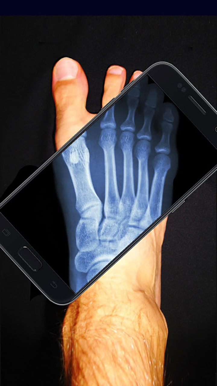 Real Xray Body Scan Filter Cam - App on the Amazon Appstore