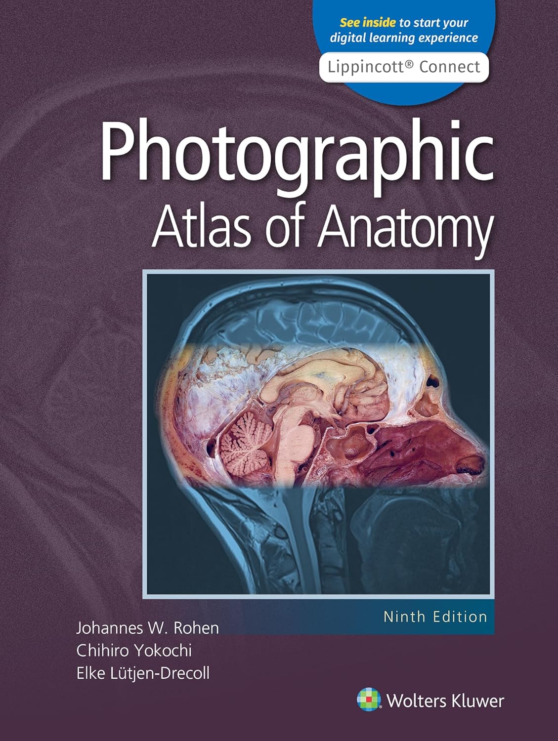 Photographic Atlas of Anatomy (Lippincott Connect) : Rohen, Johannes W ...
