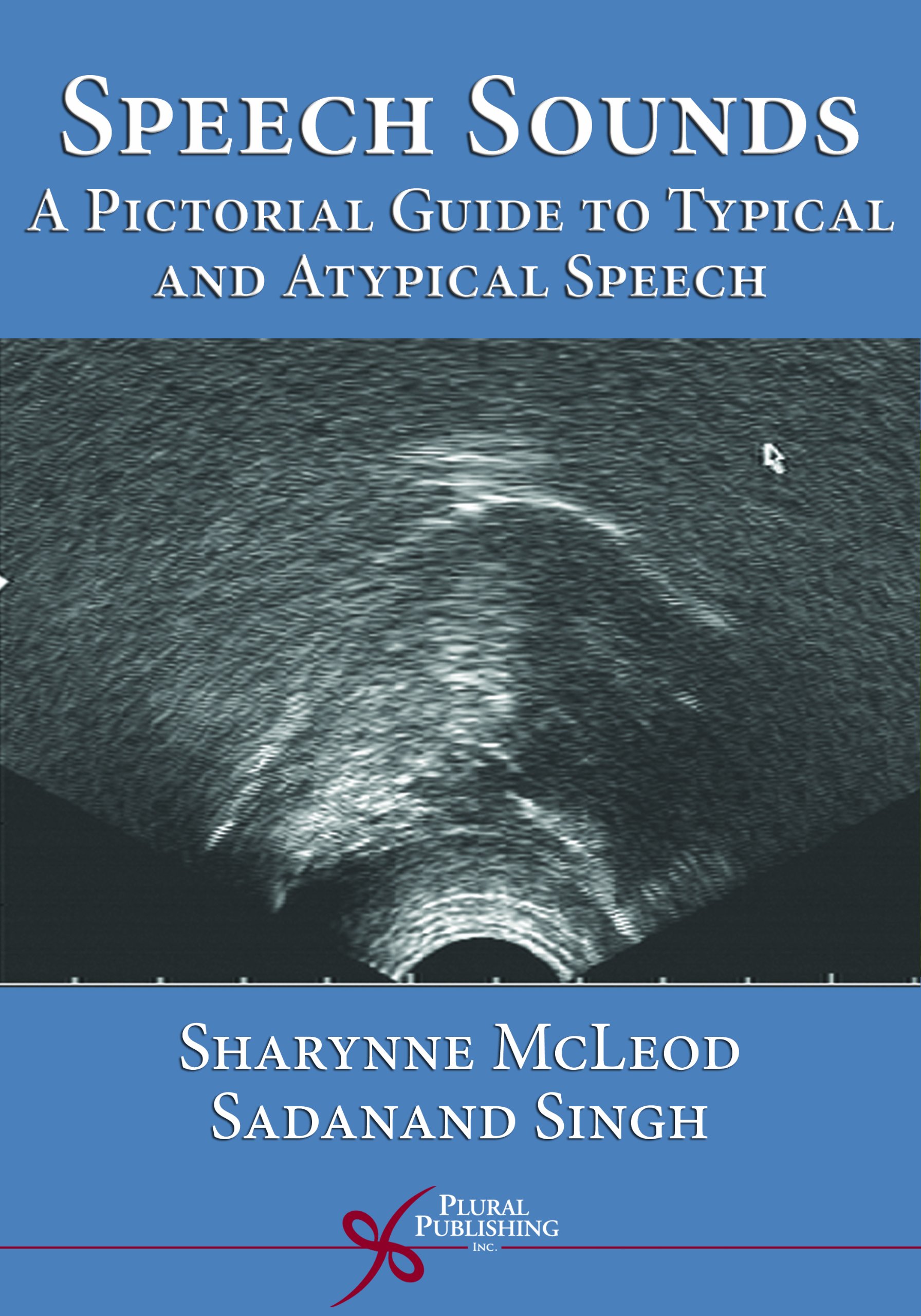 Speech Sounds: A Pictorial Guide to Typical and Atypical Speech ...